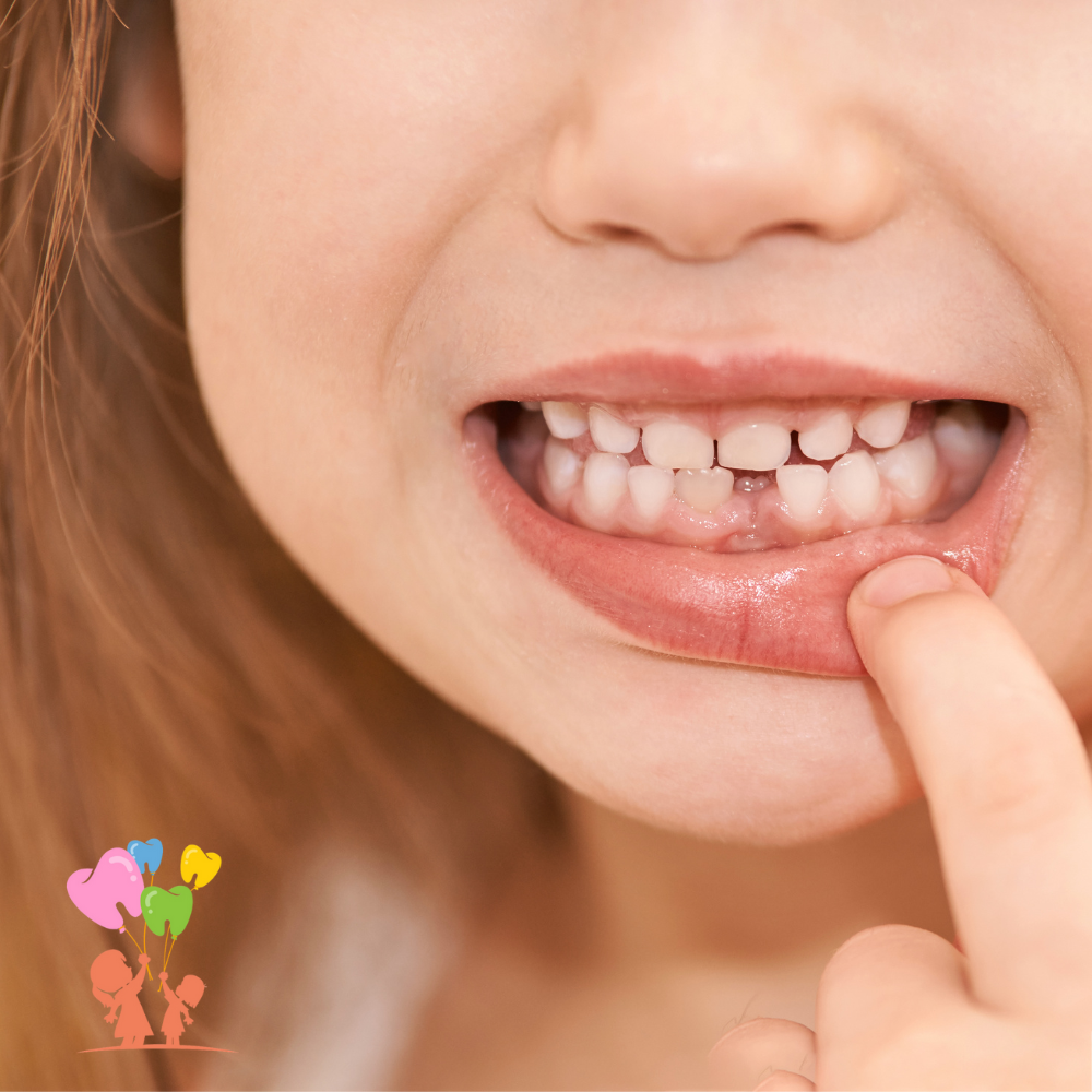 How to Make Losing a Tooth Less Scary for Your Child